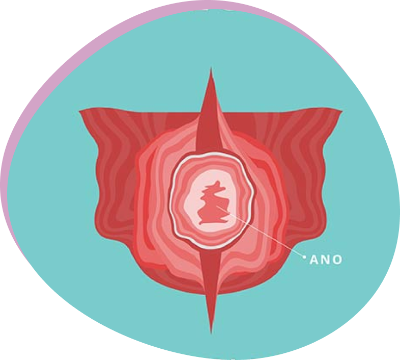 Incontinencia fecal – Clínica Colorrectal